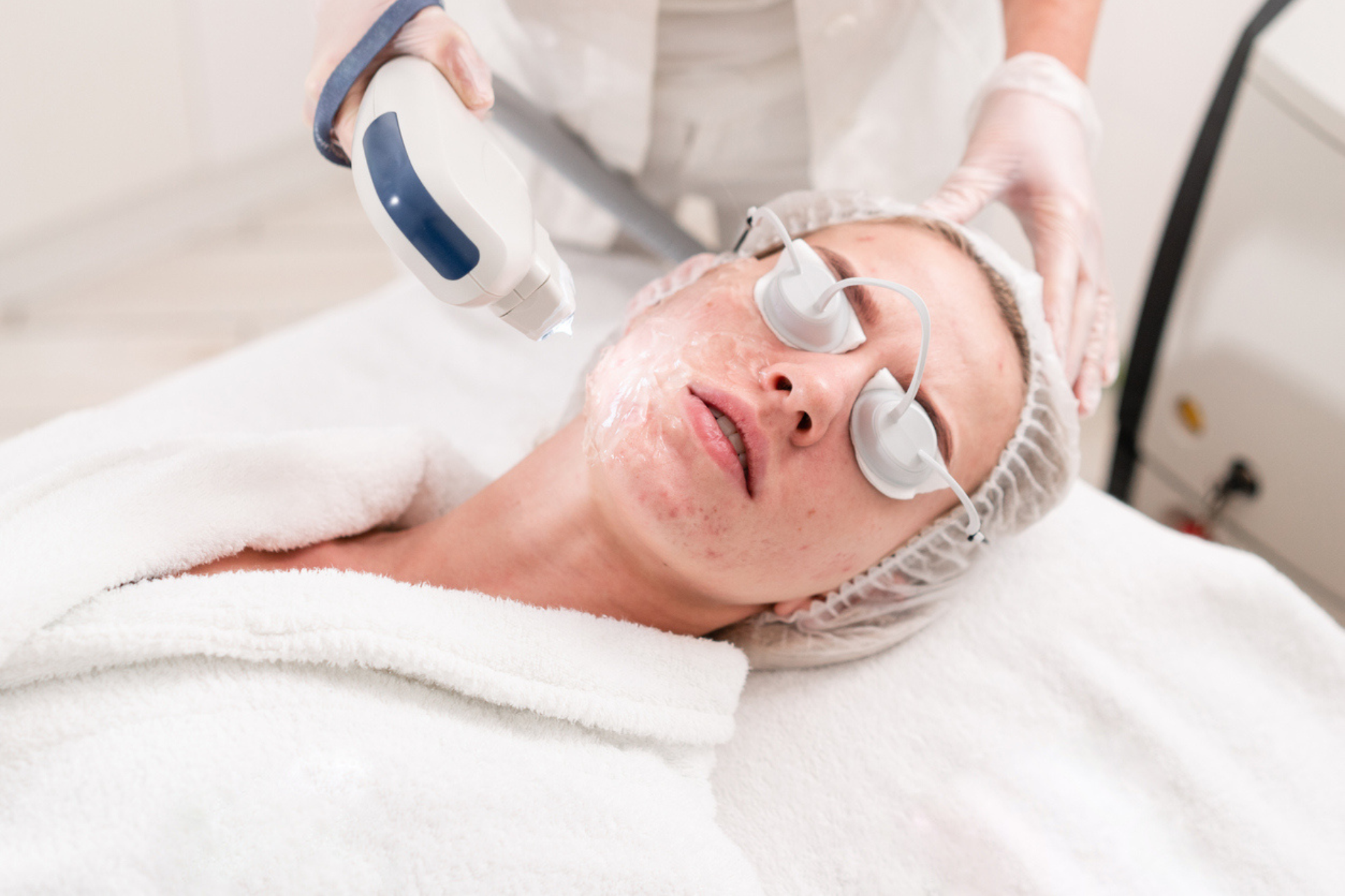 Peel & Resurfacing (Laser) - The Aesthetic Center by Medical Associates